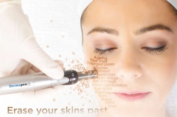 Skin Needling – Erase Yours Skins Past!